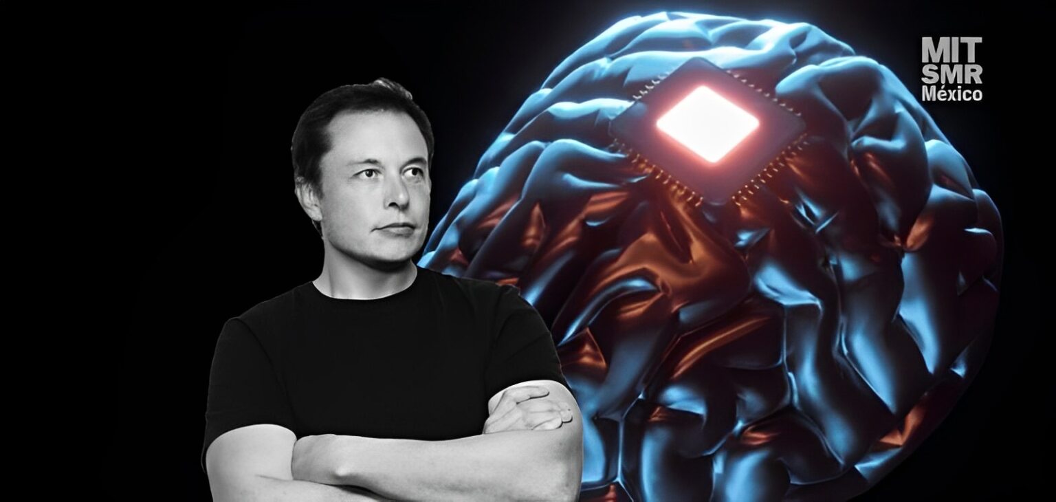 Conoce al primer paciente con el chip cerebral de Elon Musk