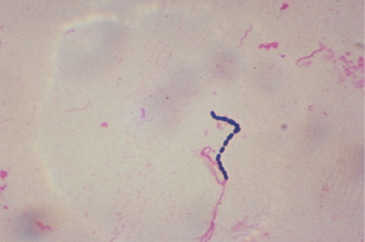 ¿Qué se sabe sobre la bacteria carnívora de Japón?